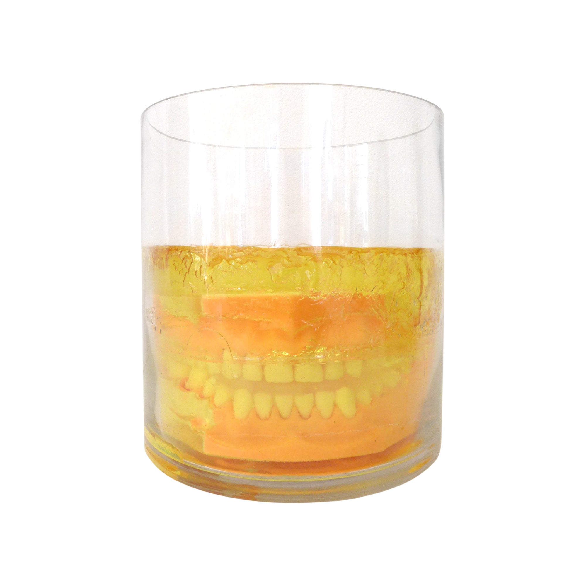 Teeth Model Encased in Acrylic – The Window